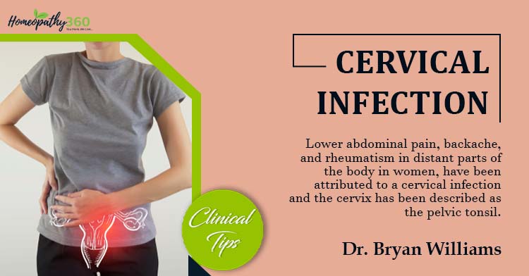 Cervical Infection: Clinical Tips by Dr. Bryan Williams