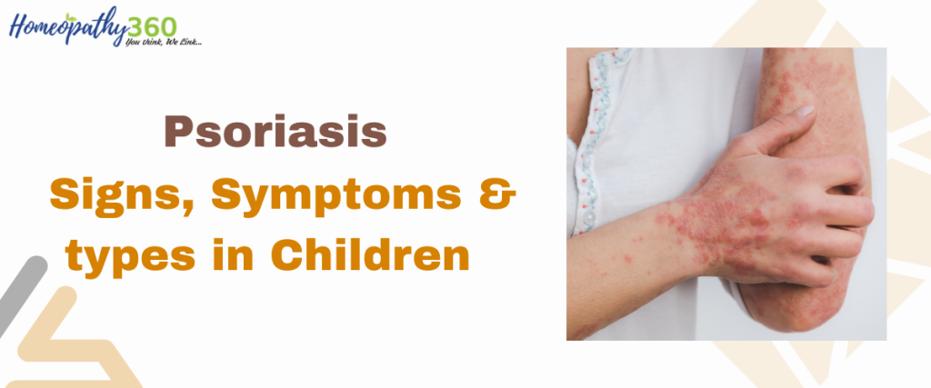 Psoriasis- Signs, Symptoms and types in Children